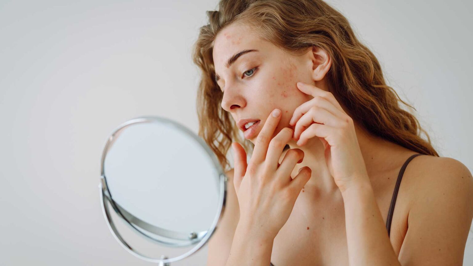 Acne Treatment Cincinnati | Choosi Skin Choosi Skin