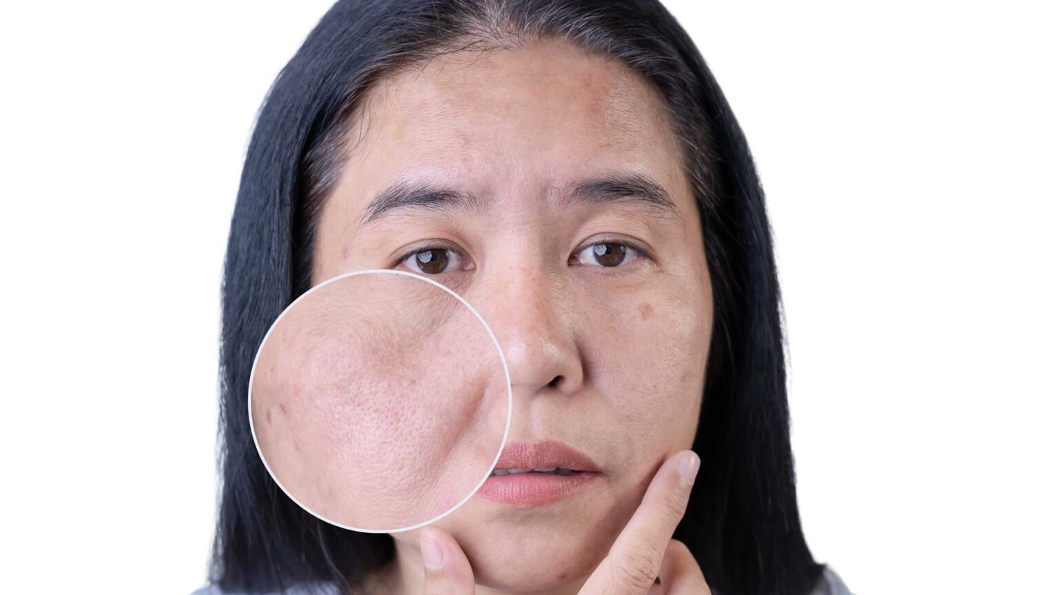 Uneven Skin Texture Treatment Cincinnati | Skin Texture Improvement ...